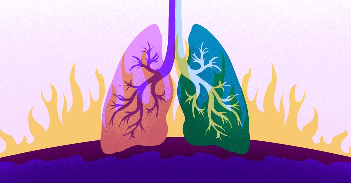 What Is a Diffusion Test (DLCO)? | COPD.net